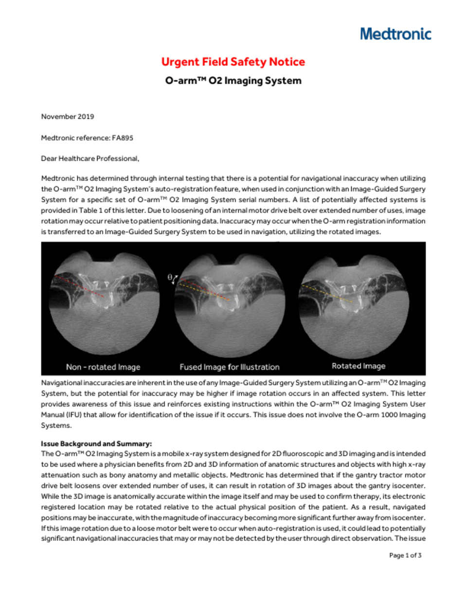 RECALL: O-arm Imaging System Urgent Field Safety Notice PDF download