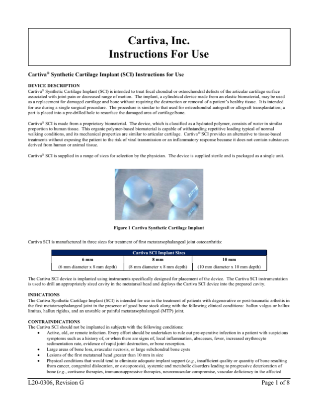 Cartiva SCI Non-sterile Instrumentation Instructions for Use PDF download